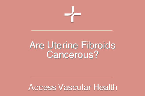 What Are Fundal Uterine Fibroids?